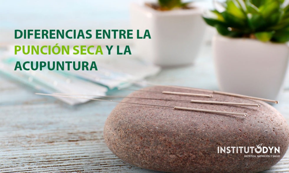 Punción seca y acupuntura: ¿en qué se diferencian? - Instituto DYN